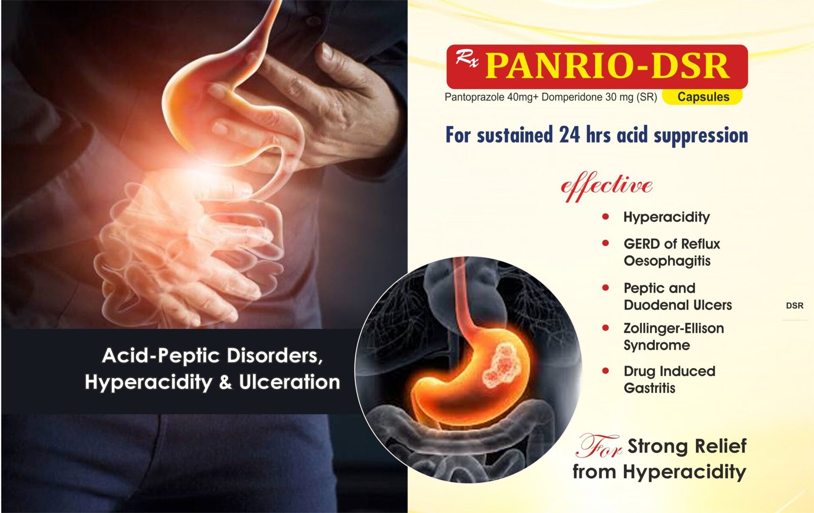 Panrio-DSR Capsules: Uses, Benefits, Side Effects, Price, Composition ...